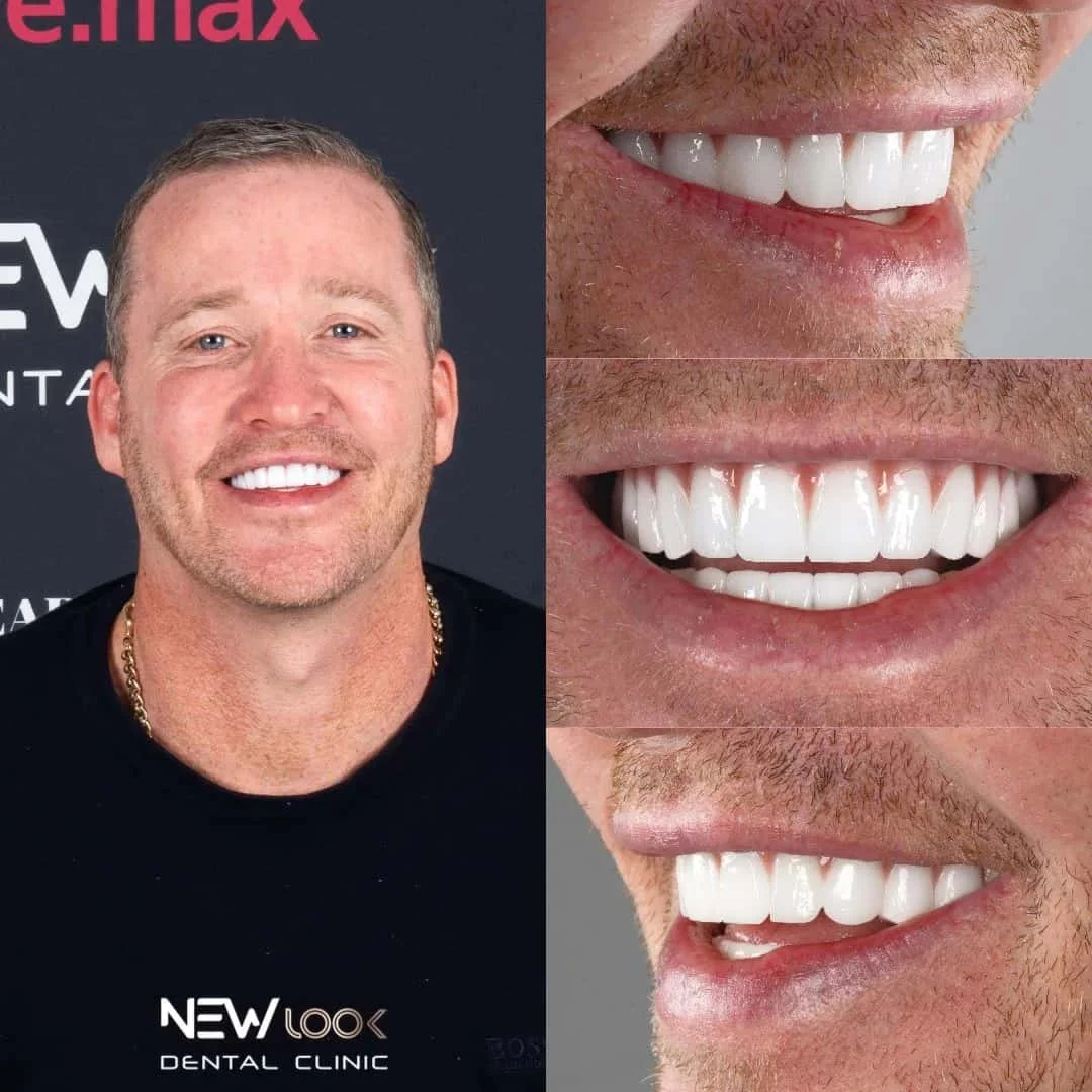 Smile Gallery - Newlooksmile